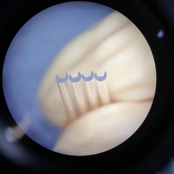 News - Custom Sized Glass Capillary Tubes